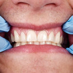 Gum Disease - Millennium Dental Technologies, Inc.