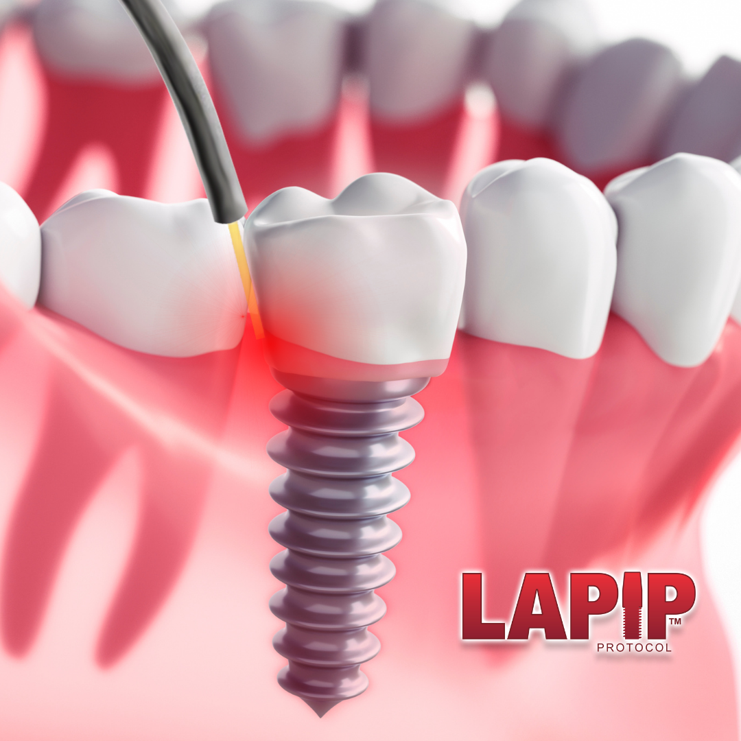 Patients - Millennium Dental Technologies, Inc.