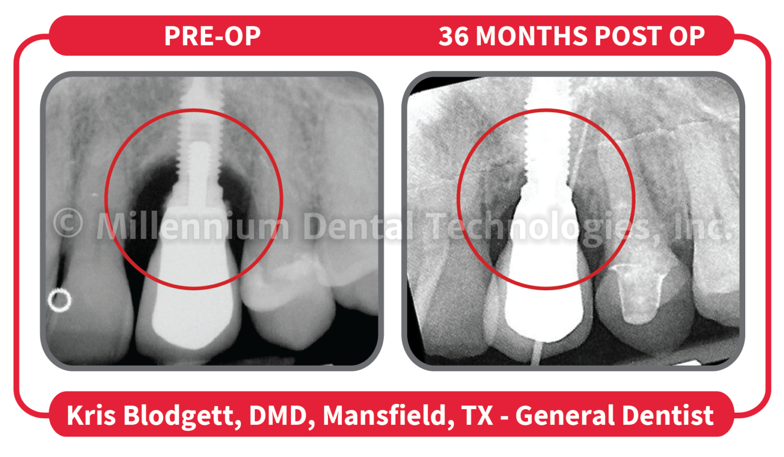 Clinicians - Millennium Dental Technologies, Inc.