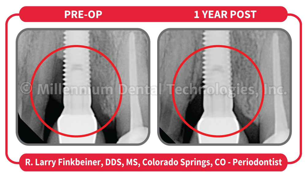 Clinicians - Millennium Dental Technologies, Inc.
