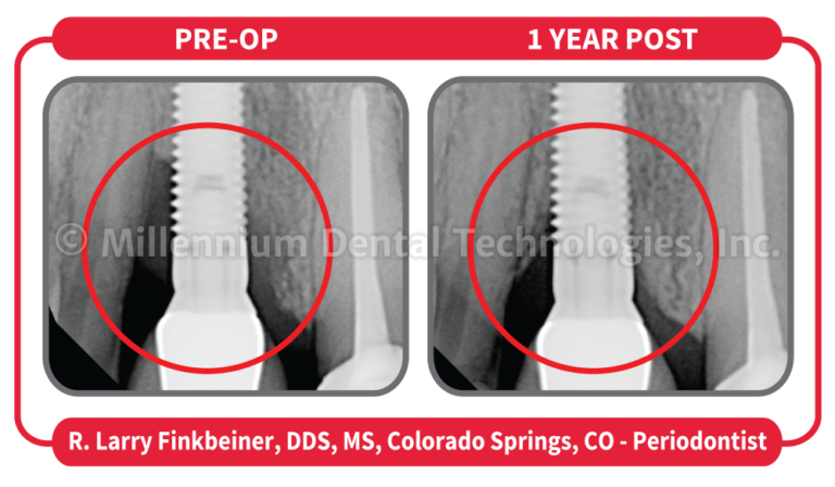 Clinicians - Millennium Dental Technologies, Inc.