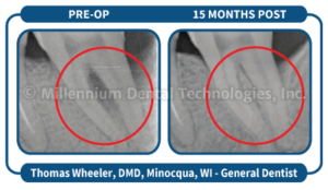 Clinicians - Millennium Dental Technologies, Inc.
